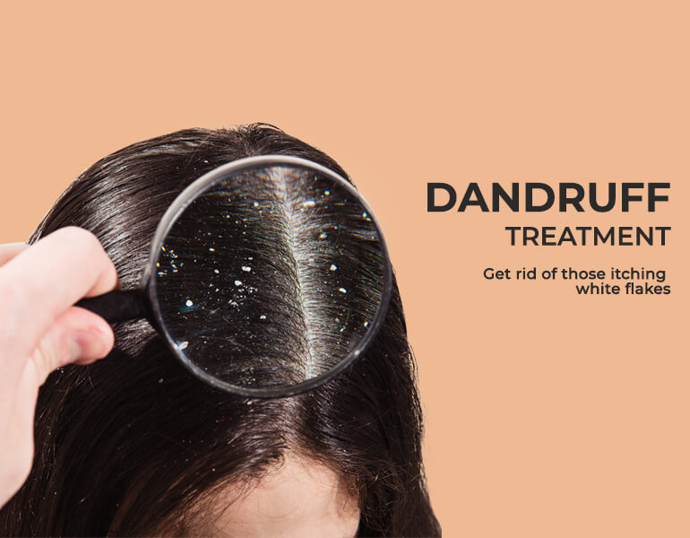 Dandruff Treatment – Dandruff Removal in Bangalore, Hyderabad, Chennai