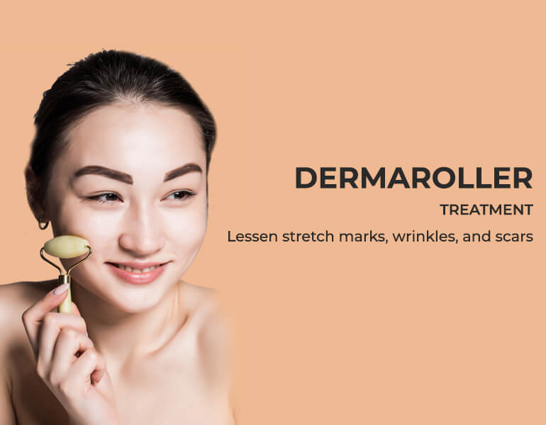 Derma Roller Treatment for Acne Scars in Hyderabad, Chennai, Bangalore