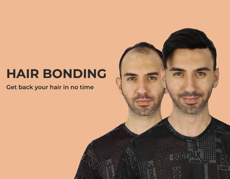 Hair Bonding in Chennai | Hair Bonding Clinic & Treatments